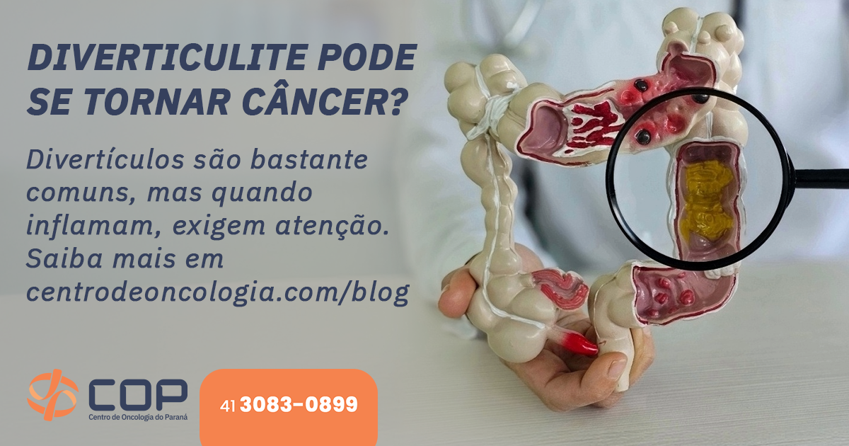 Diverticulite pode se tornar câncer? - Oncologia em Curitiba - Centro ...